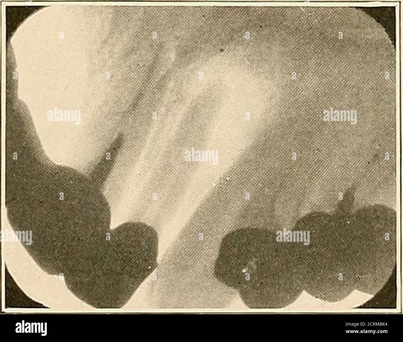 Sepsis word hi-res stock photography and images - Alamy