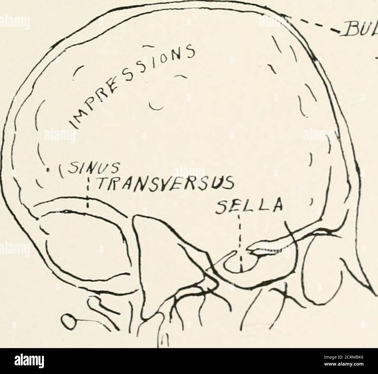 Transverse sinus hi-res stock photography and images - Alamy
