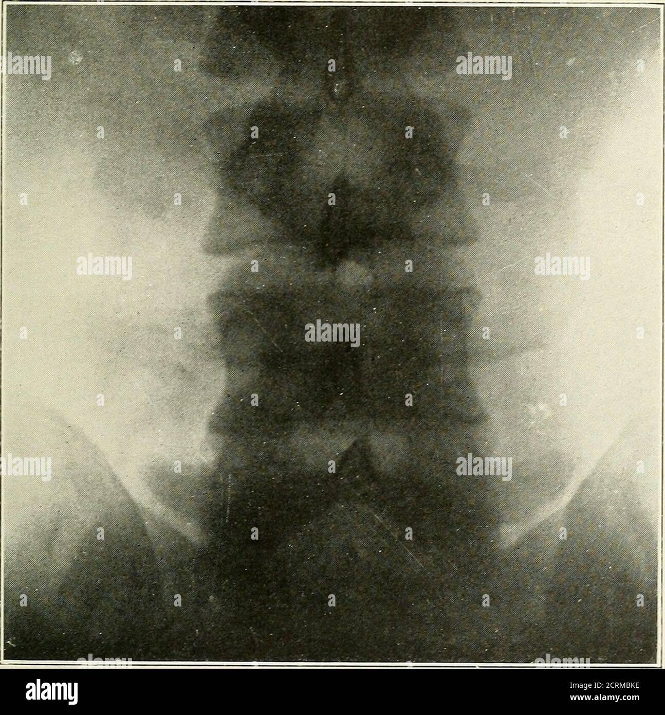. Roentgen interpretation; a manual for students and practitioners ...