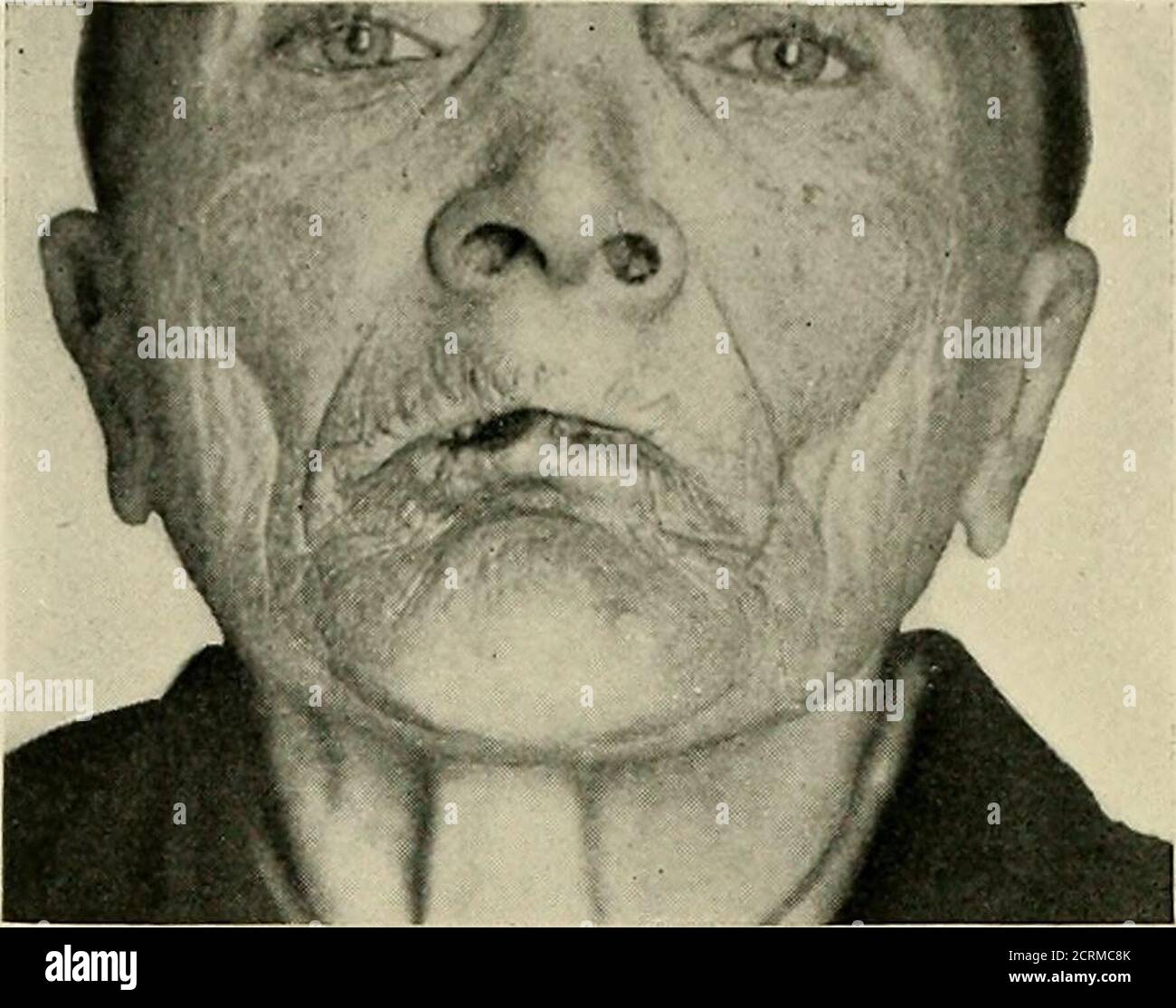 . Radiotherapy and phototherapy : including radium and high-frequency ...