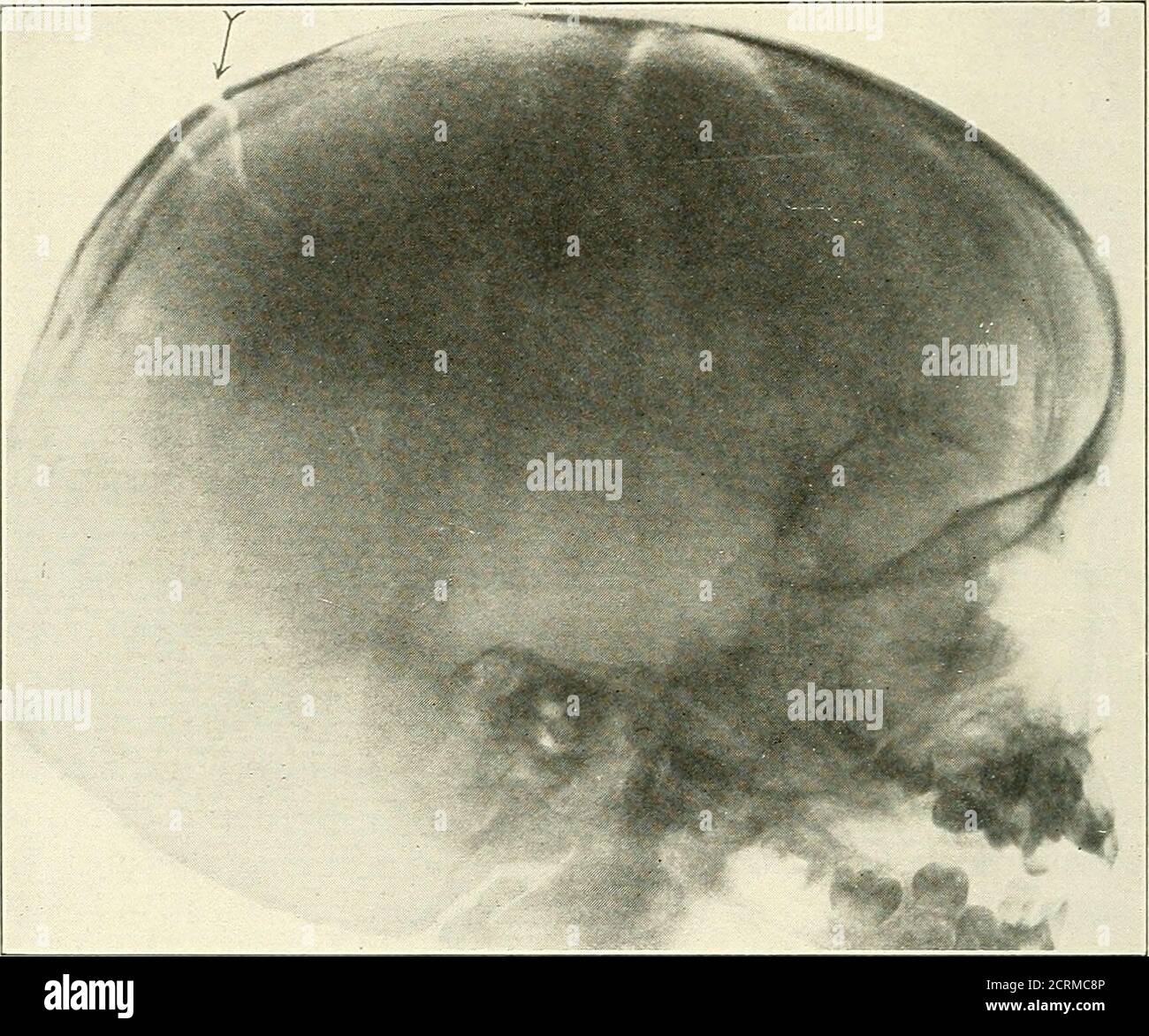 . Roentgen interpretation; a manual for students and practitioners ...