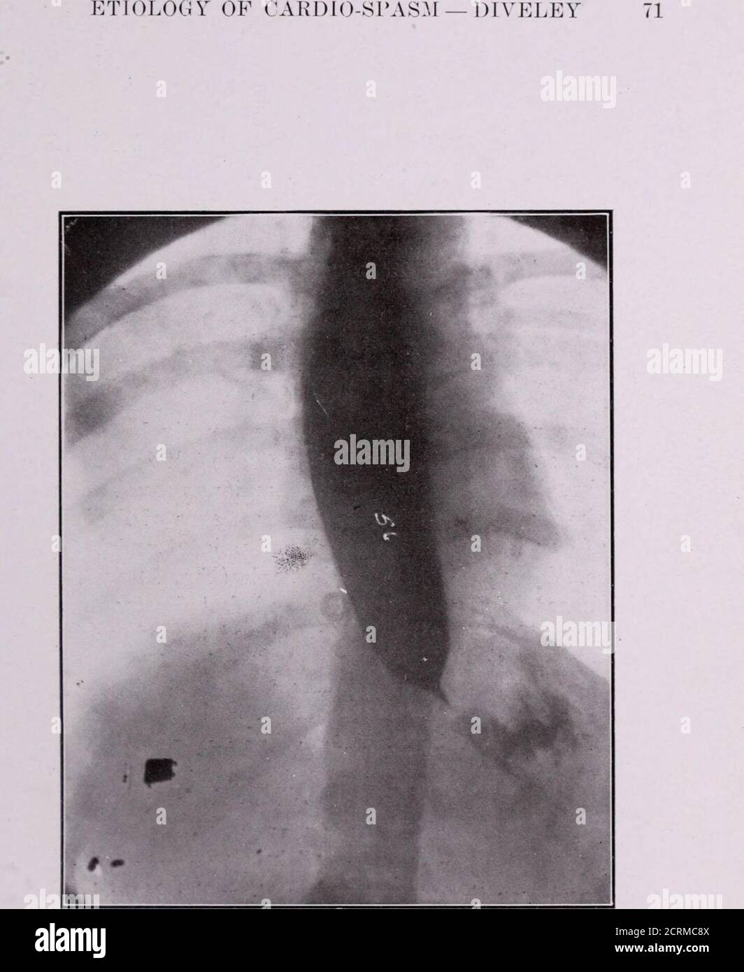 Sarcoma leg hi-res stock photography and images - Alamy