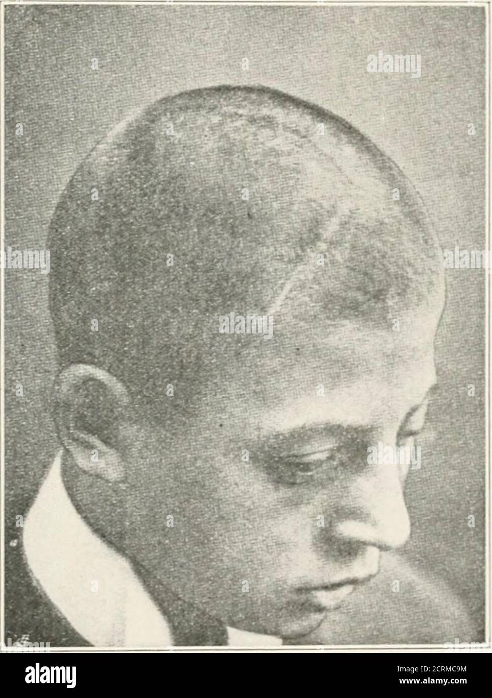 Micro roentgen hi-res stock photography and images - Alamy