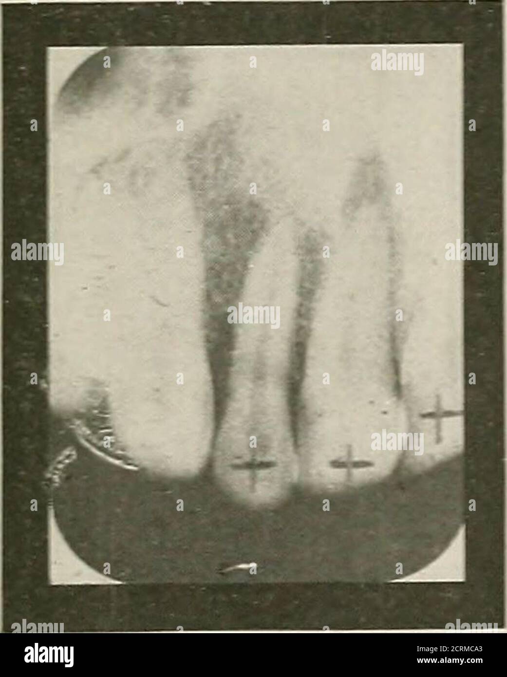 Radiographic detail hi-res stock photography and images - Alamy