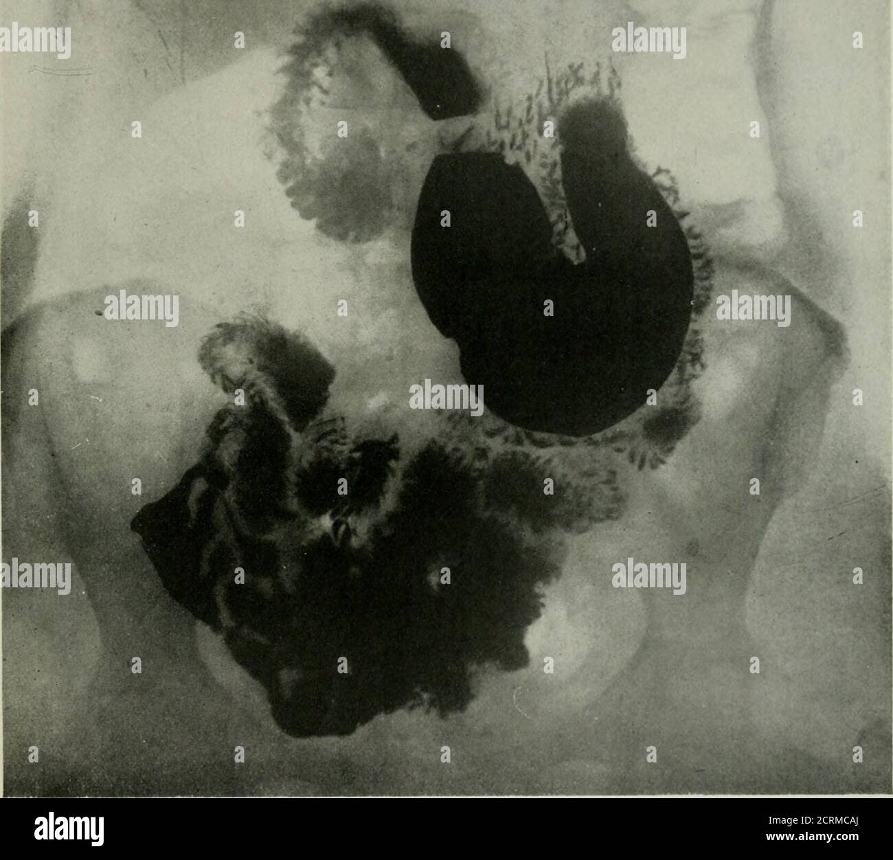 Magenblase hi-res stock photography and images - Alamy