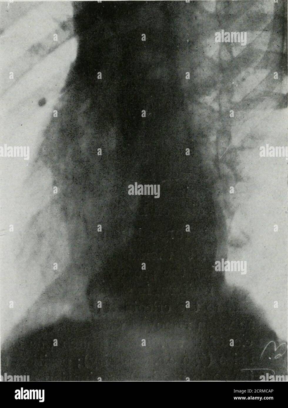 . The American journal of roentgenology, radium therapy and nuclear ...