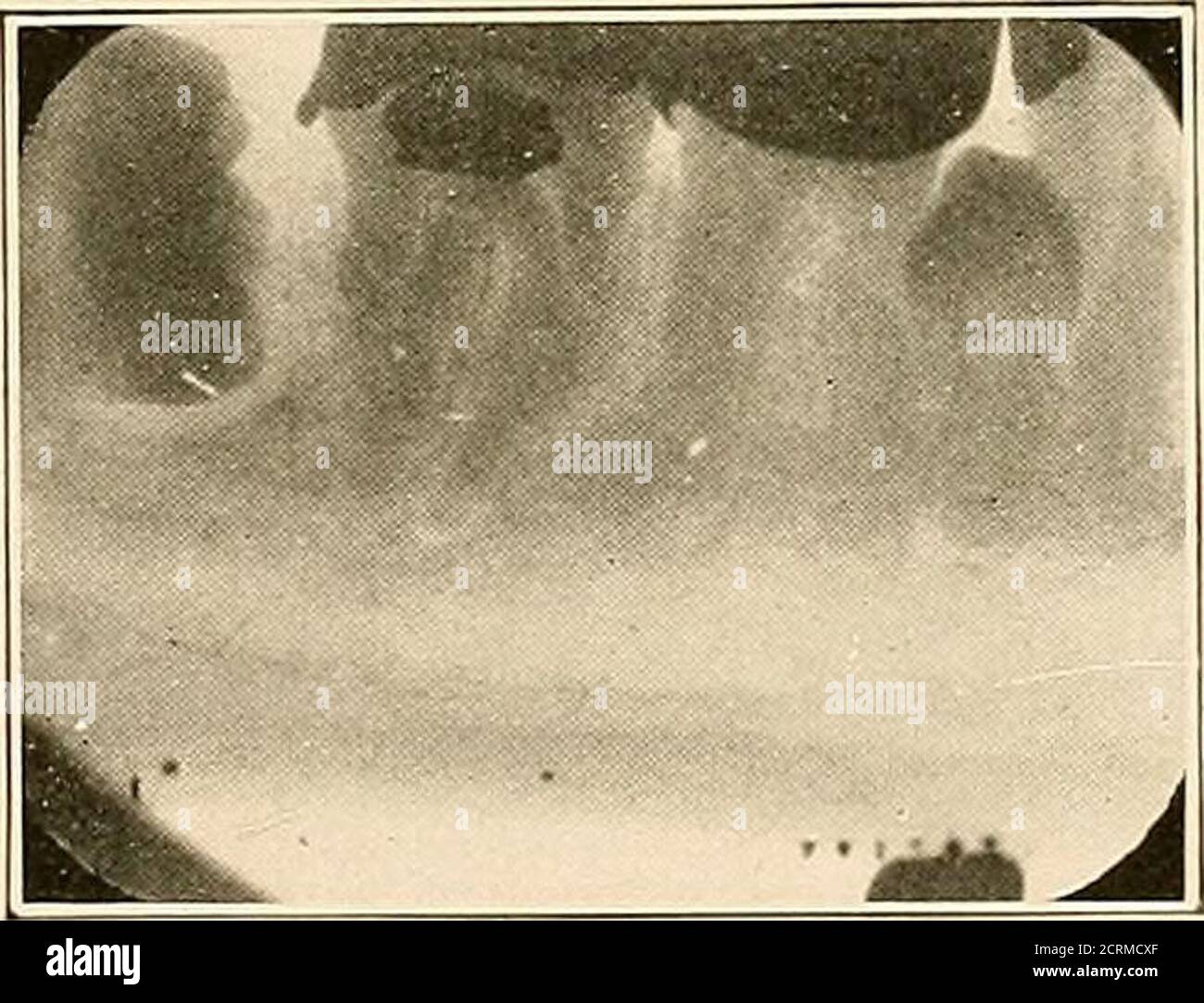 Dental_treatment hi-res stock photography and images - Alamy