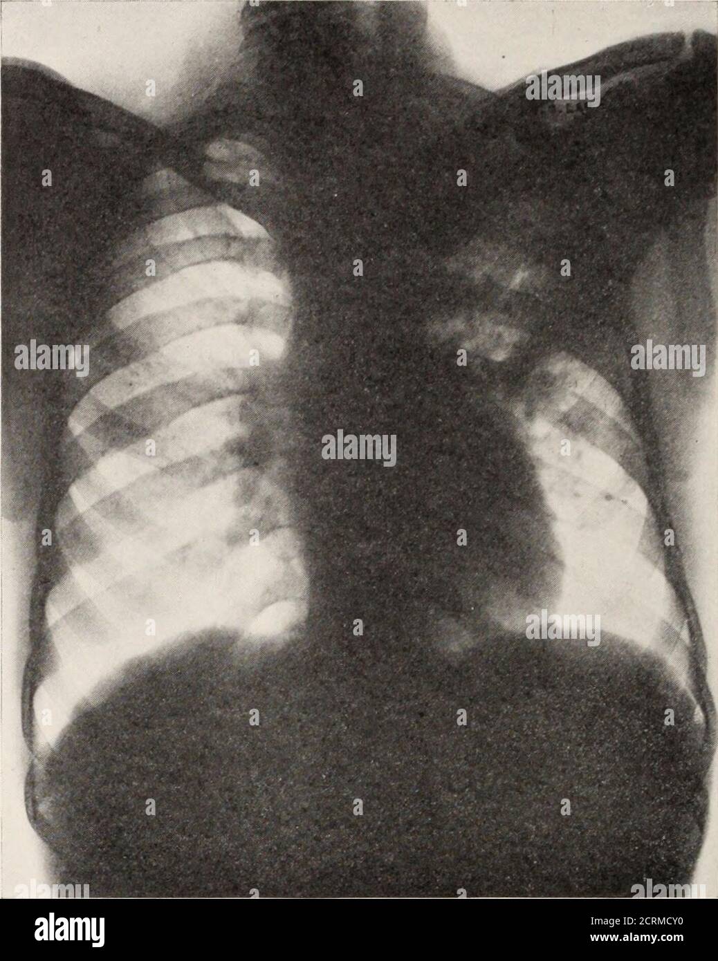 . Journal of roentgenology . No. 4829 Report from stereo-roentgenogram ...