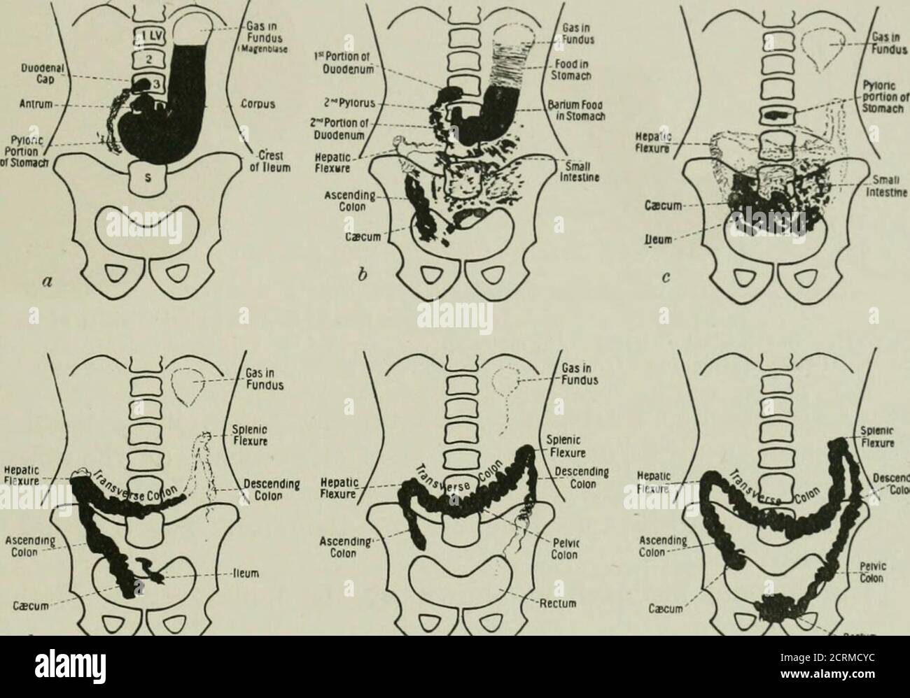 . Radiography and radio-therapeutics . cending colon visible. (/) 7 P.M ...