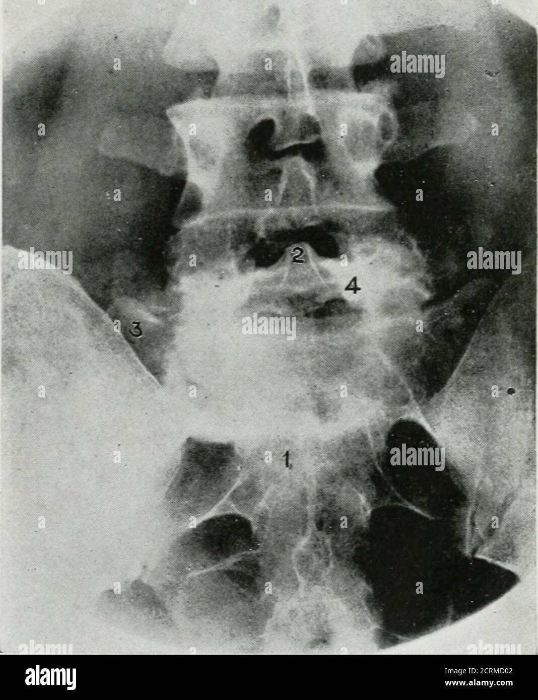 Sacralized hi-res stock photography and images - Alamy