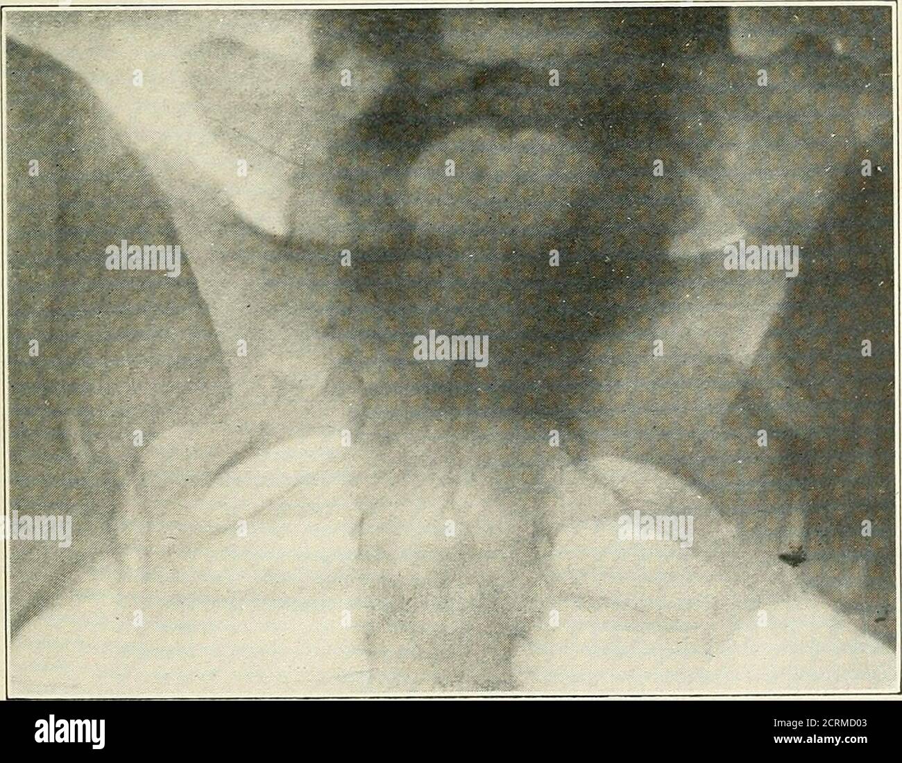 Anatomical variation hi-res stock photography and images - Alamy