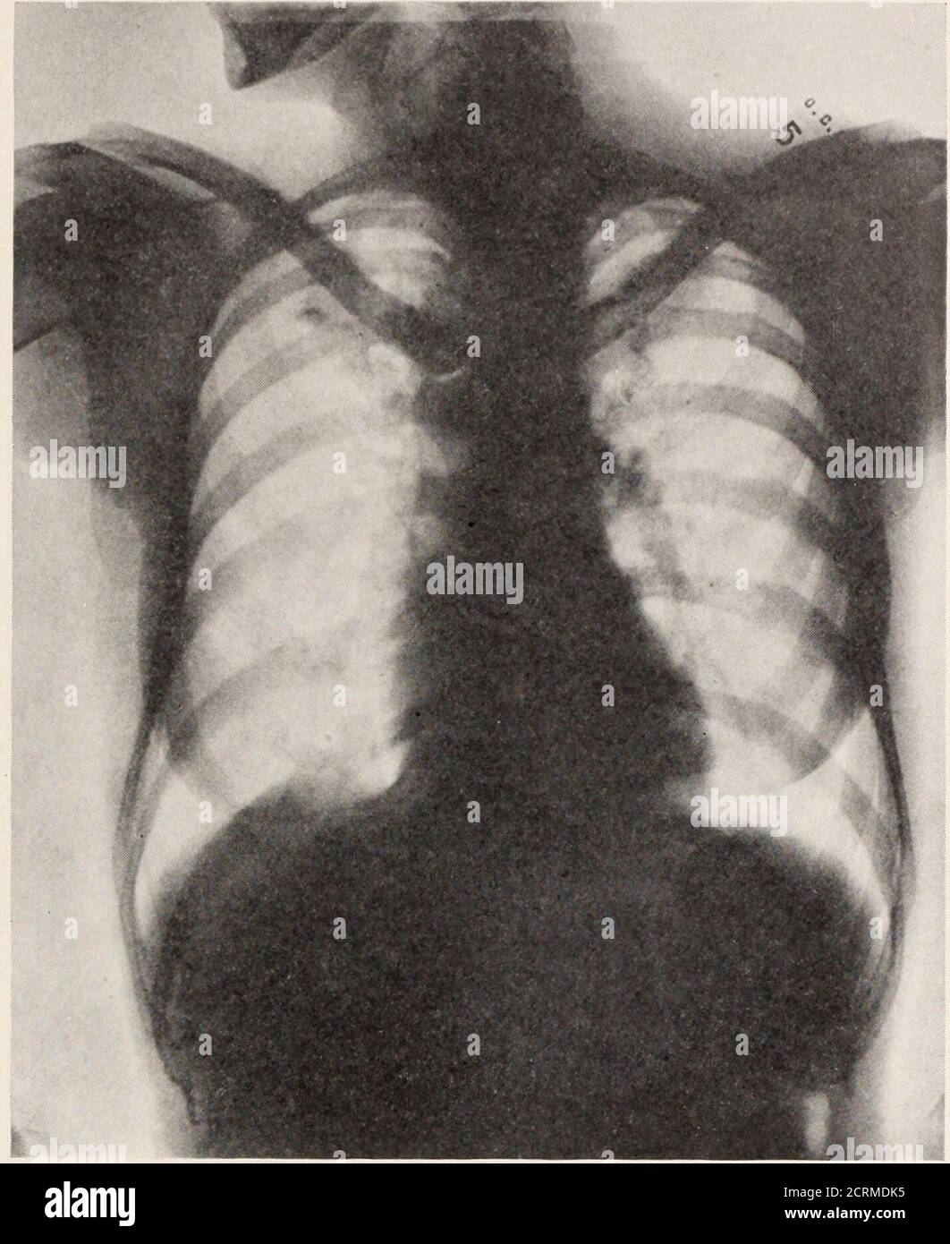 . Journal of roentgenology . Figure 2 This figure illustrates the ...