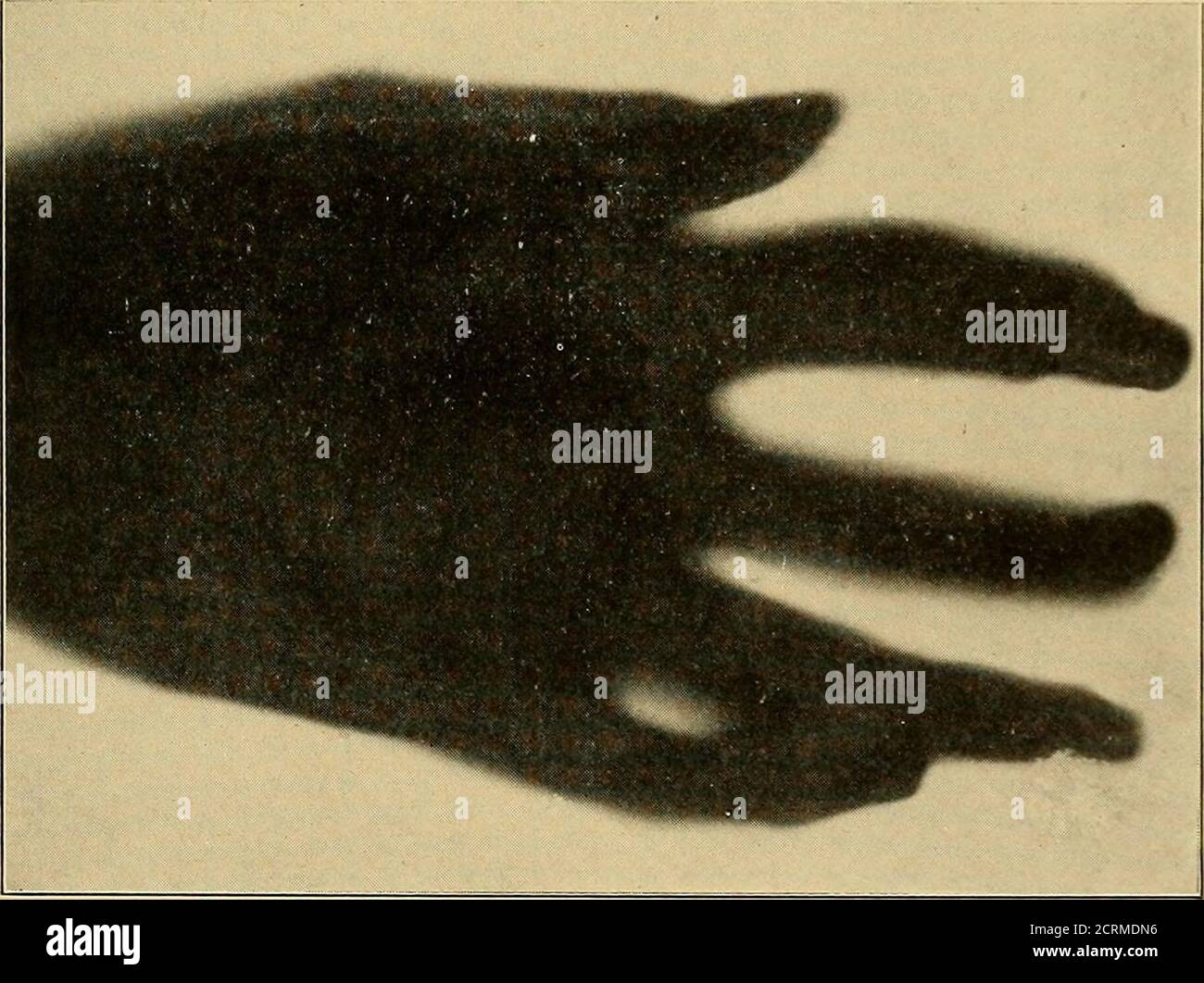 . Light energy, its physics, physiological action and therapeutic ...