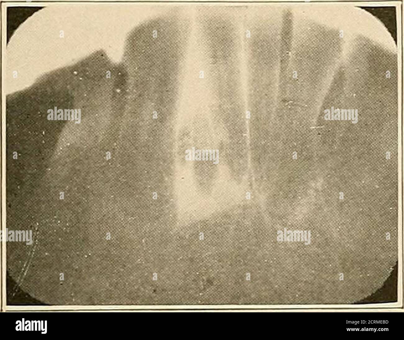 . Oral sepsis in its relationship to systemic disease . Fig. 80. Fig ...