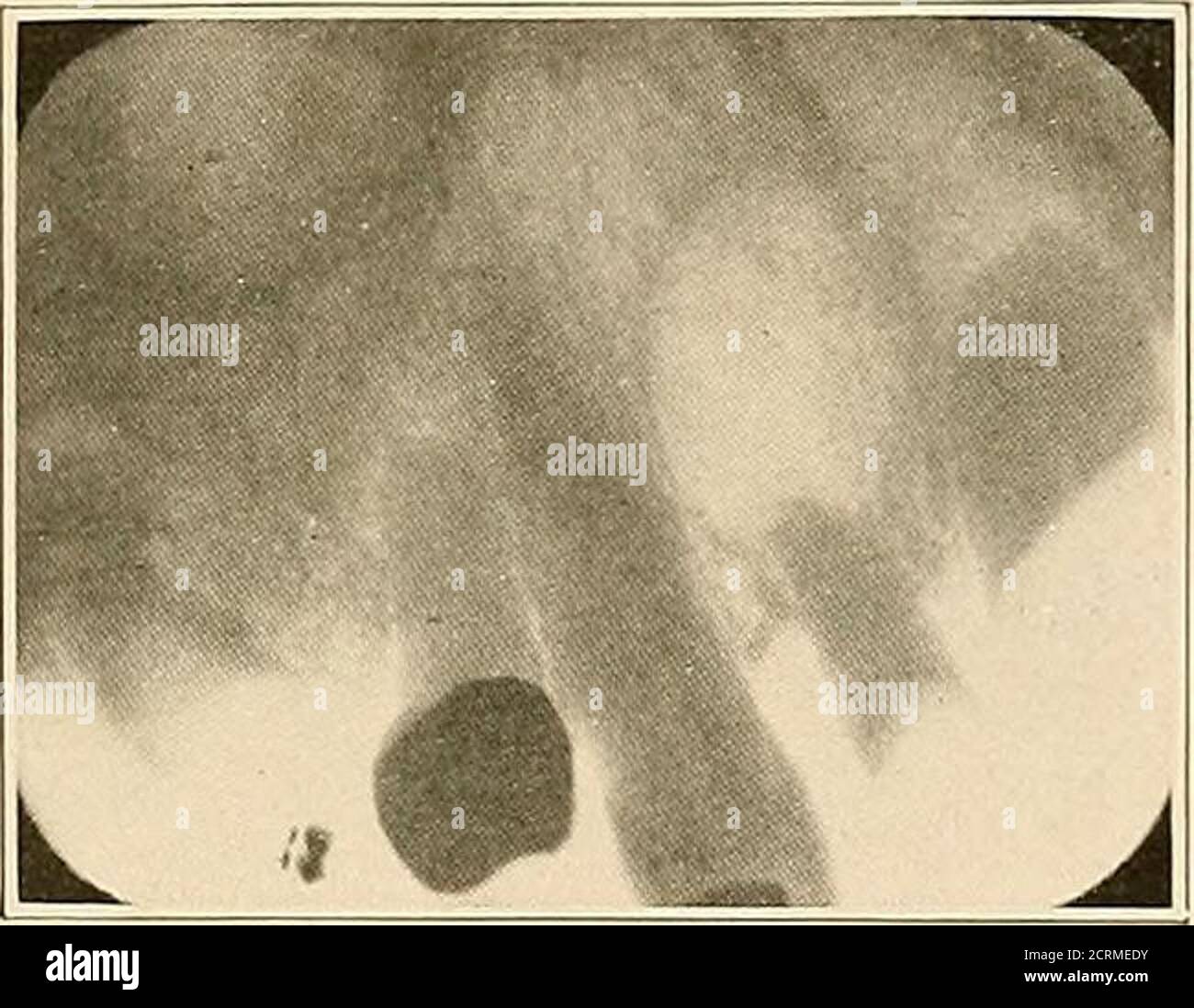 . Oral sepsis in its relationship to systemic disease . Fig. 78. Fig ...