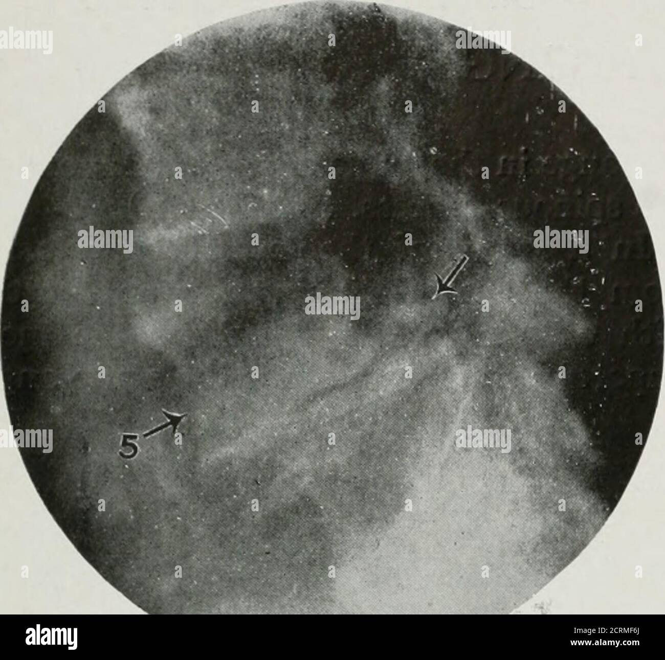 Normal bone density hi-res stock photography and images - Alamy