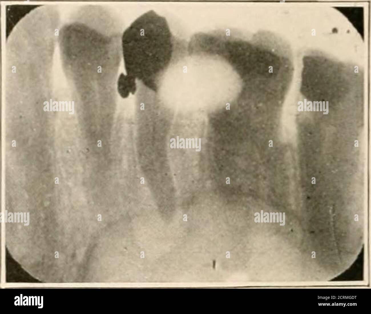. Oral sepsis in its relationship to systemic disease . Fig. 64. Fig ...
