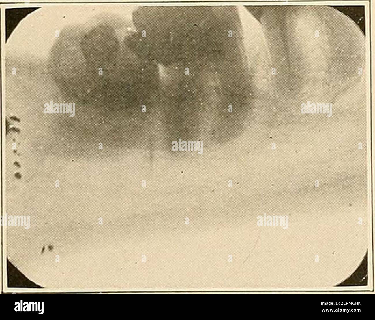 . Oral sepsis in its relationship to systemic disease . Fig. 62. Fig ...