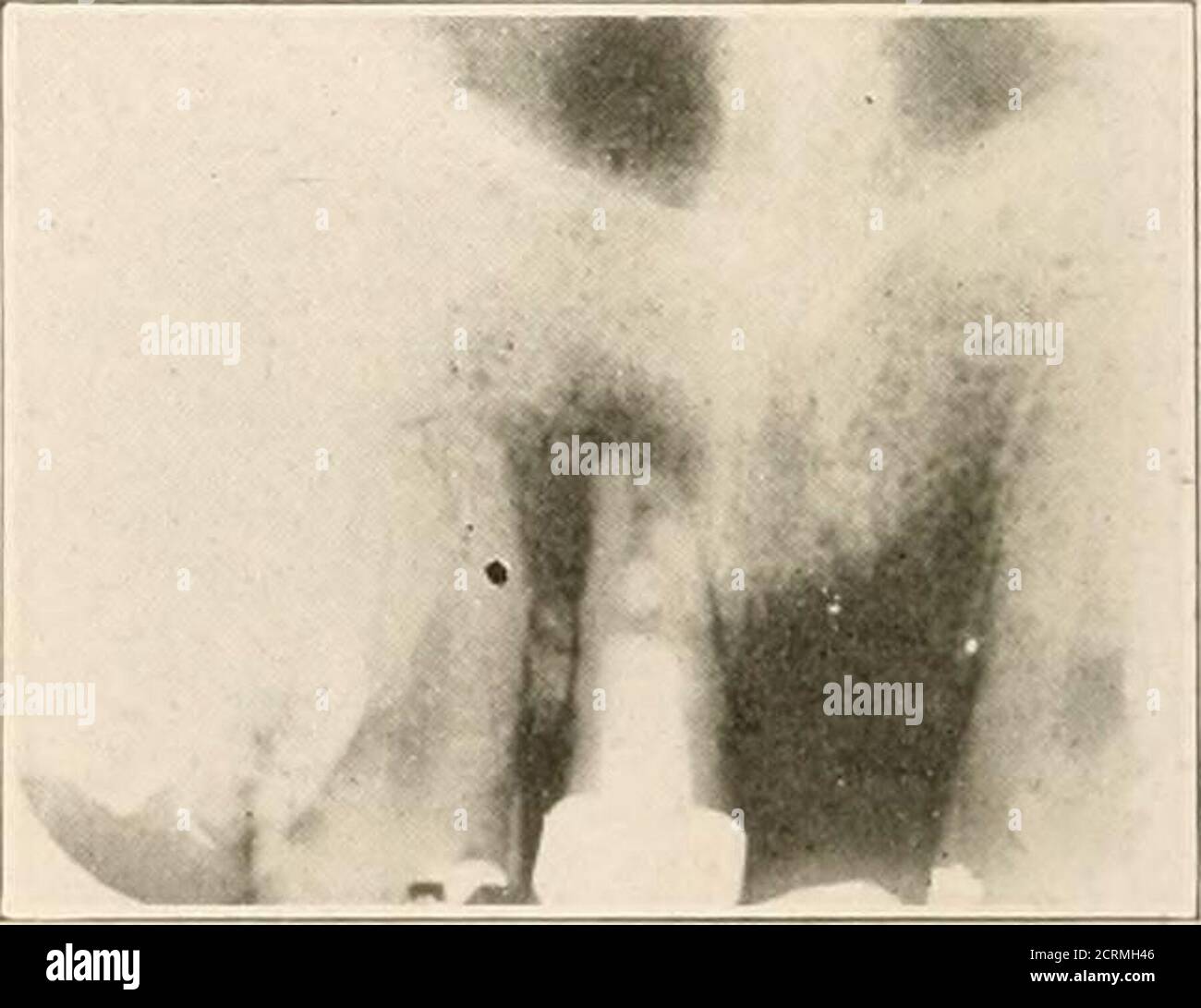 Turbinates hi-res stock photography and images - Alamy