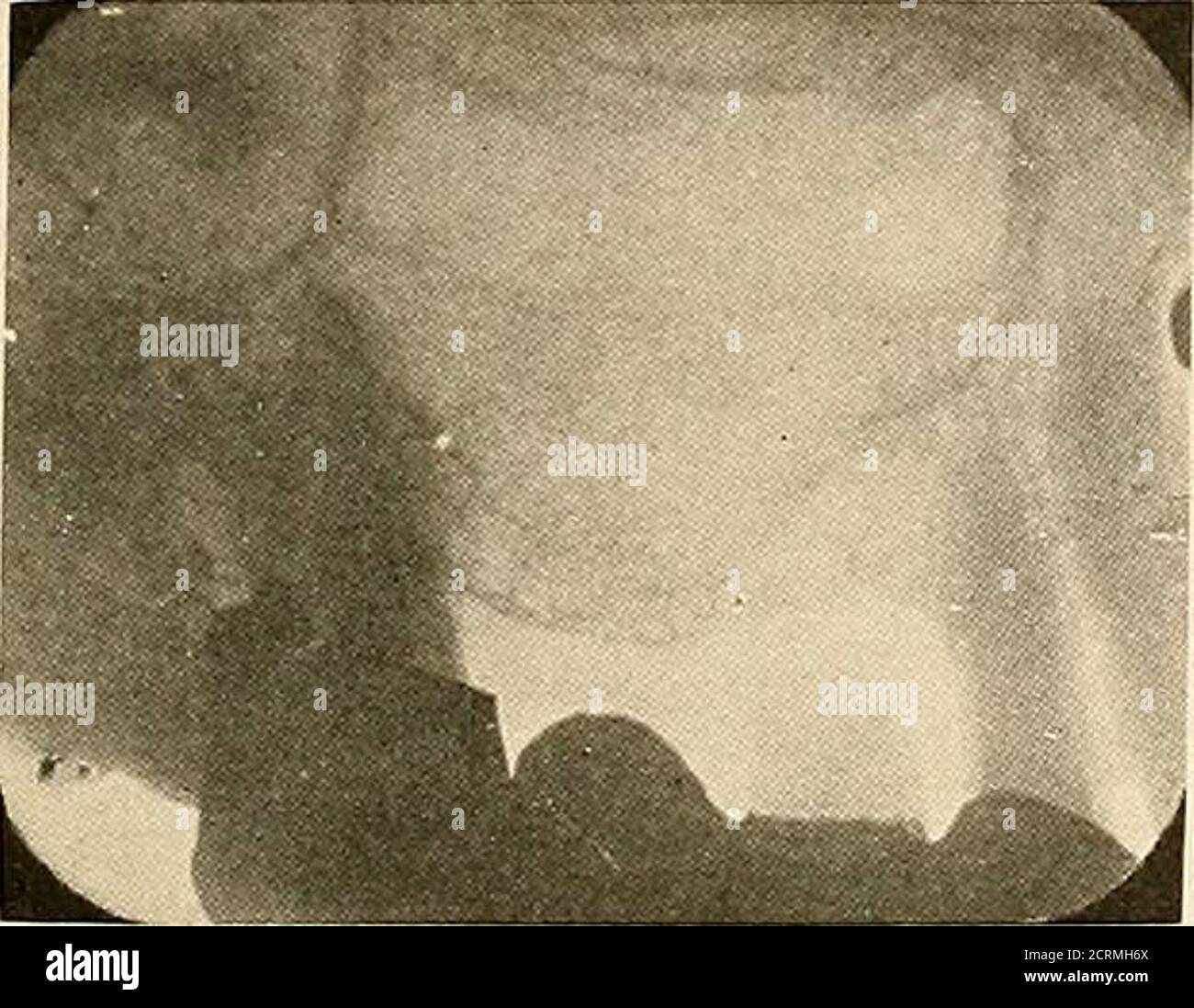 . Oral sepsis in its relationship to systemic disease . Fig. 58. Fig ...