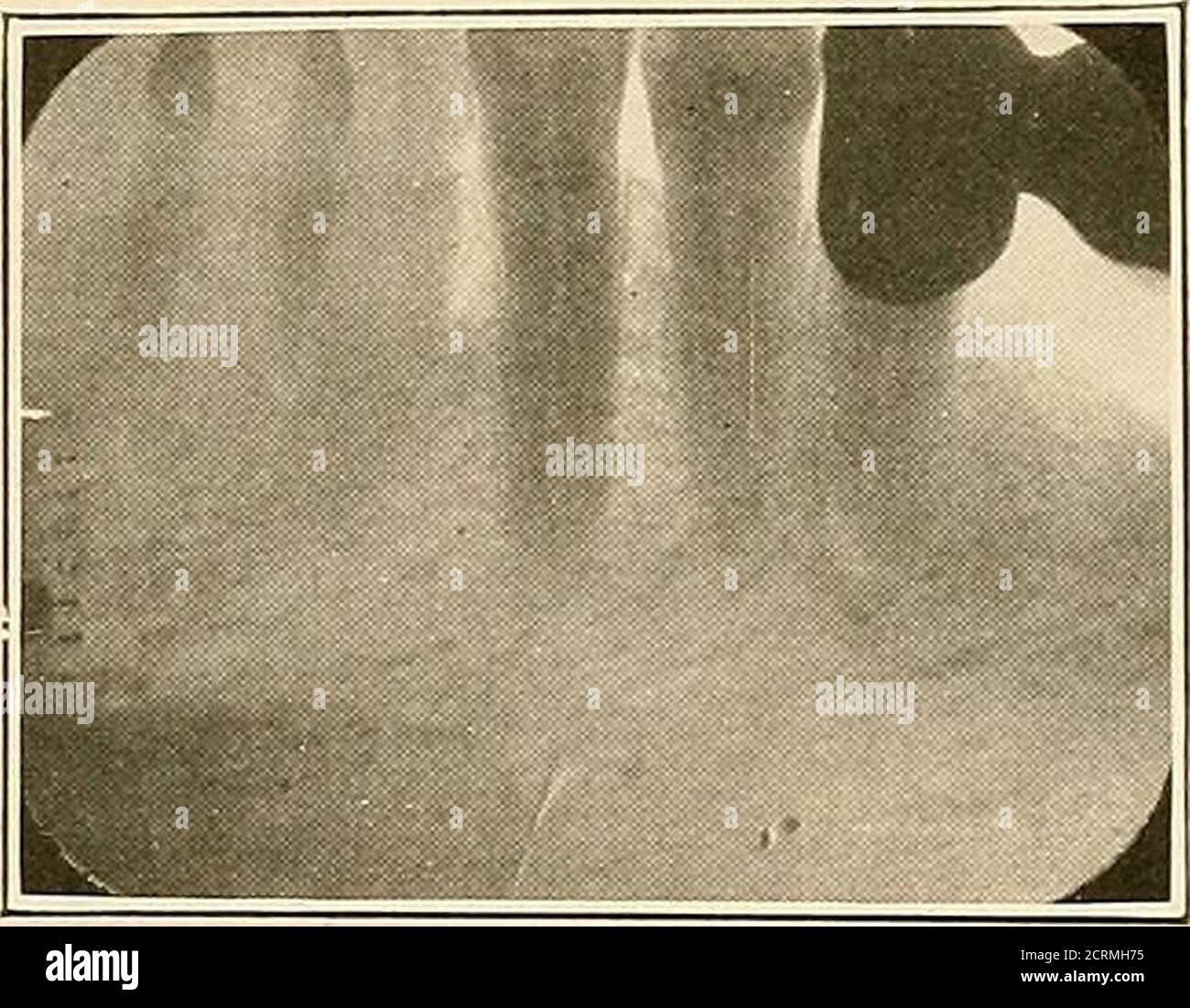 . Oral sepsis in its relationship to systemic disease . Fig. 62. Fig ...