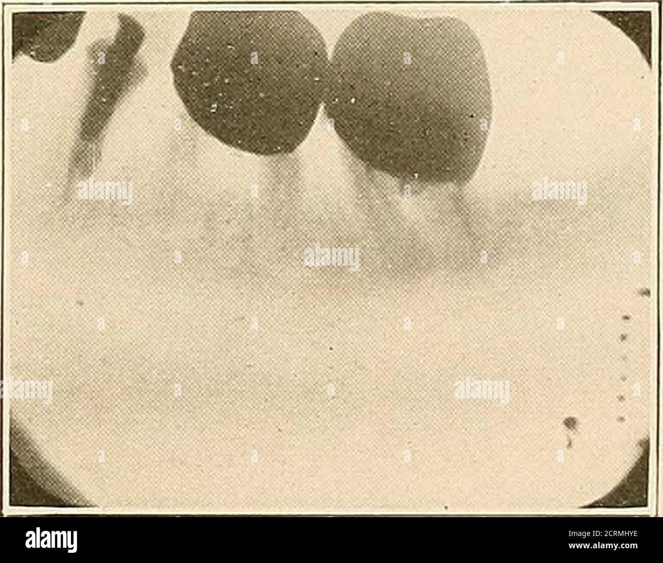 . Oral sepsis in its relationship to systemic disease . Fig. 53.. Fig ...