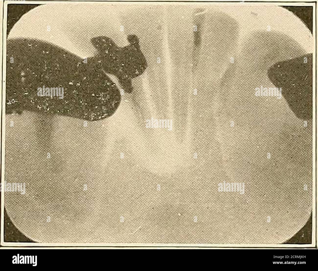. Oral sepsis in its relationship to systemic disease . Fig. 54.. Fig ...