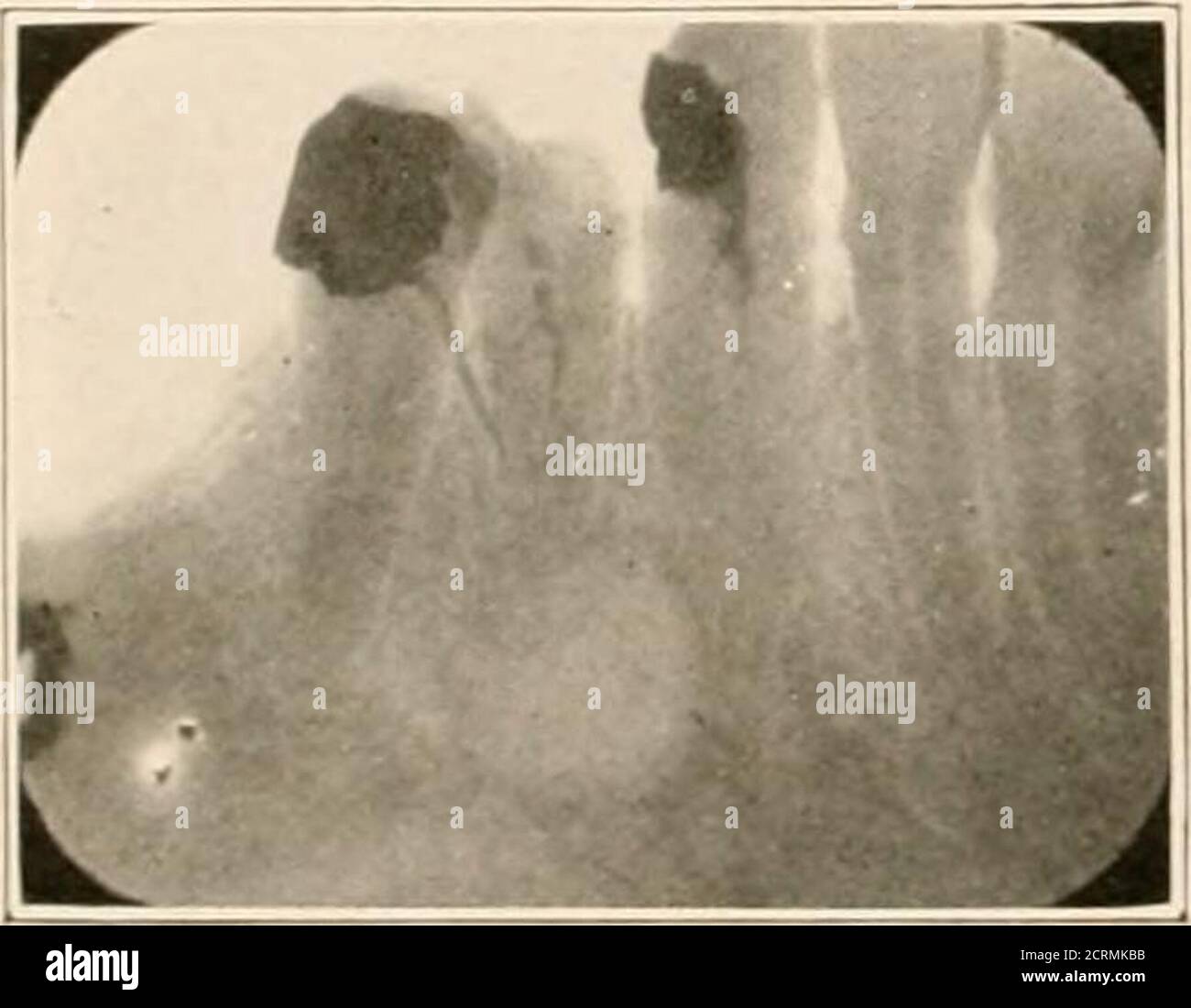 . Oral sepsis in its relationship to systemic disease . F g. 46. Fig ...