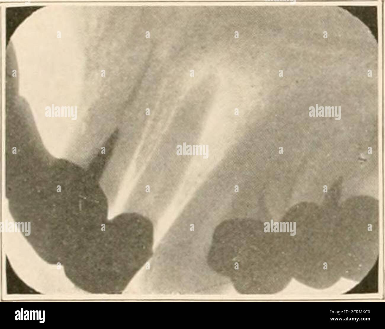 . Oral sepsis in its relationship to systemic disease . Fig. 37. Fig ...