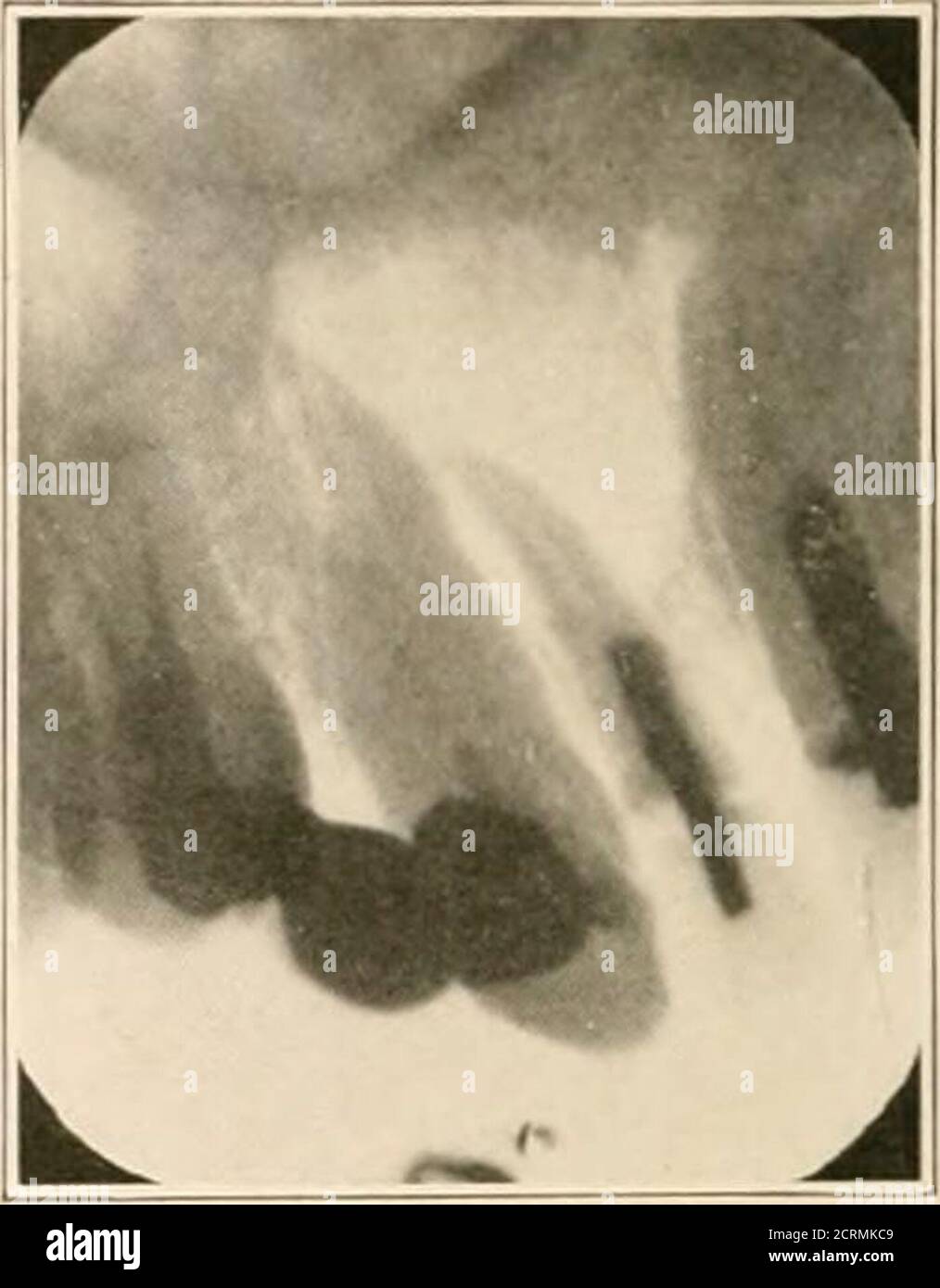 . Oral sepsis in its relationship to systemic disease . Fig. 37. Fig ...