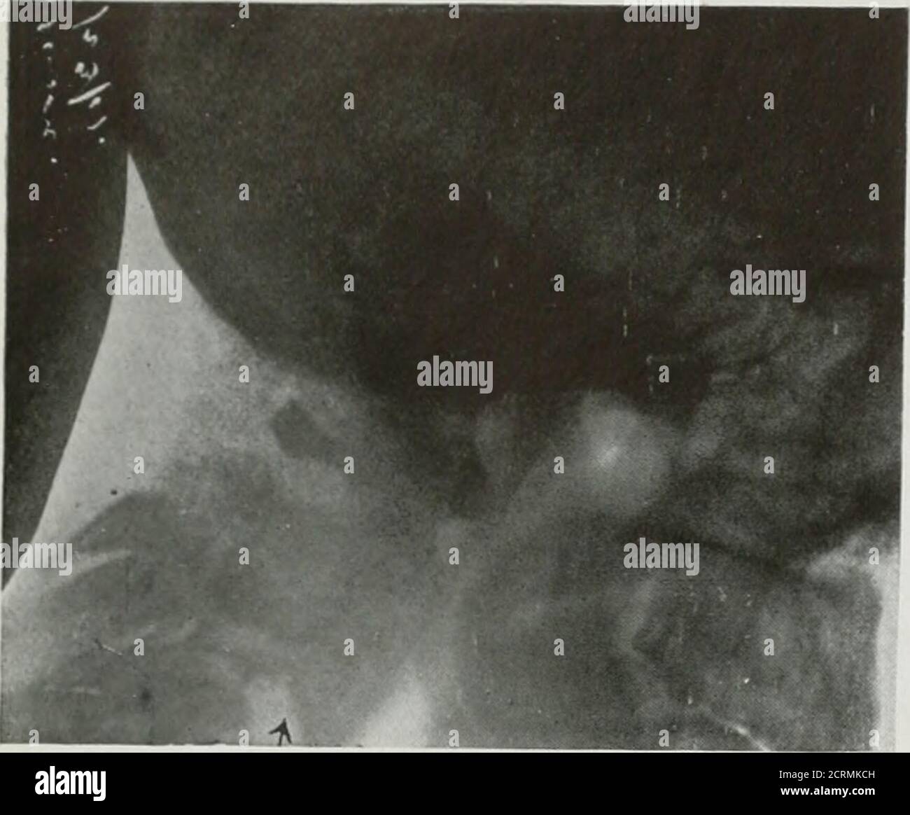 . The American journal of roentgenology, radium therapy and nuclear ...