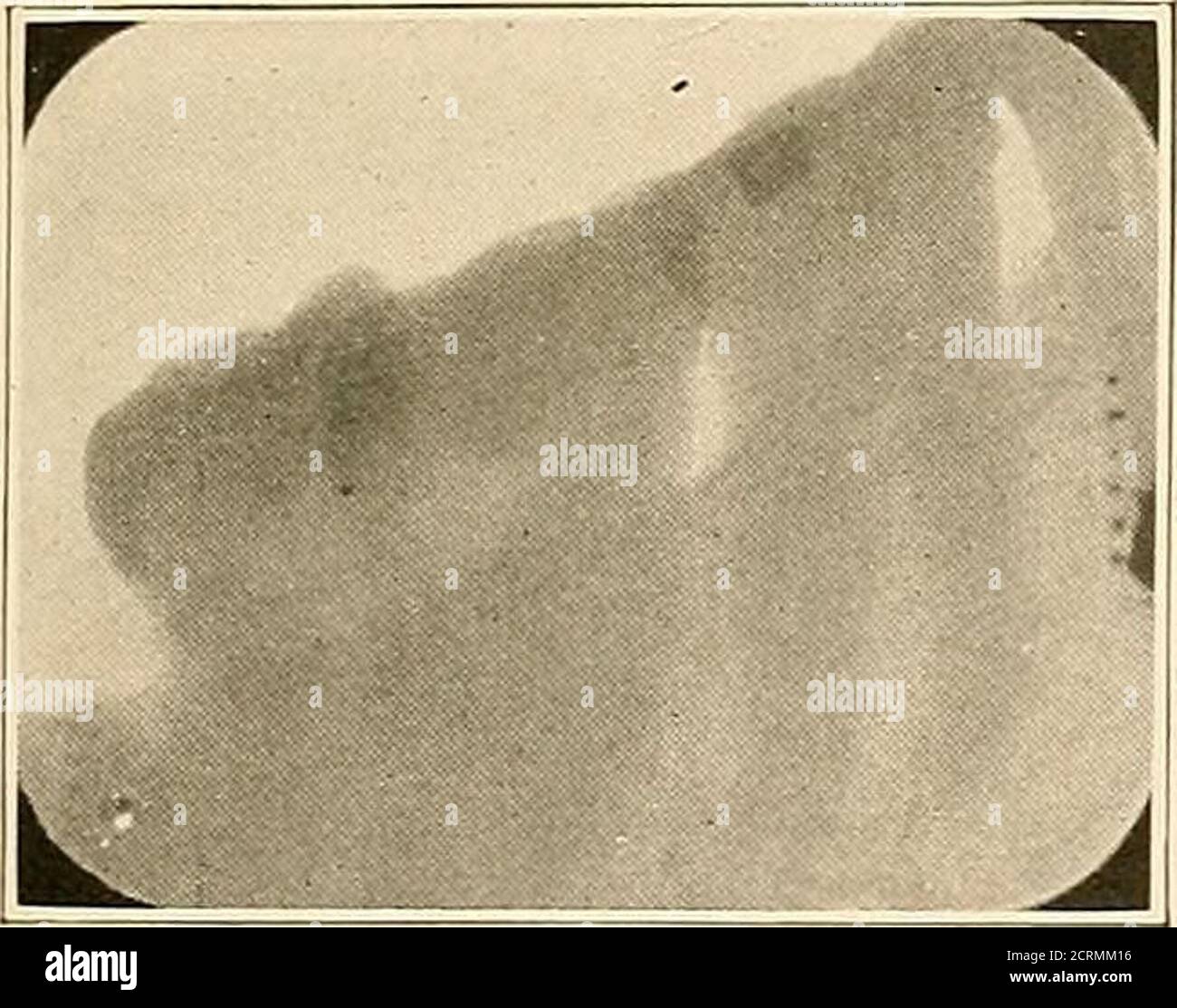 . Oral sepsis in its relationship to systemic disease . Fig. 33. Fig ...