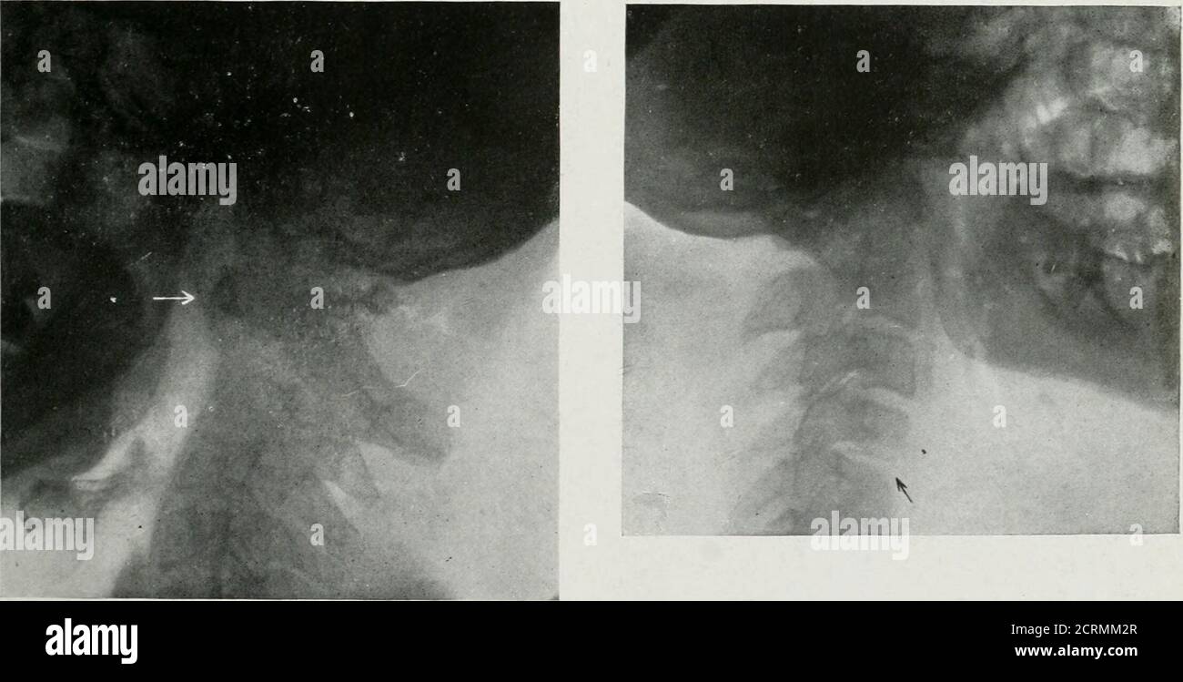 . The American journal of roentgenology, radium therapy and nuclear ...