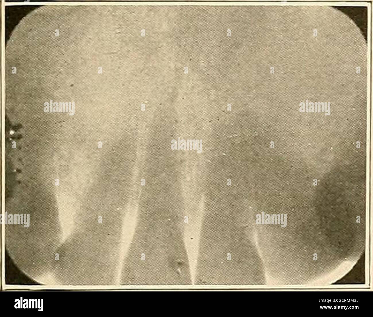 . Oral sepsis in its relationship to systemic disease . Fig. 31. Fig ...