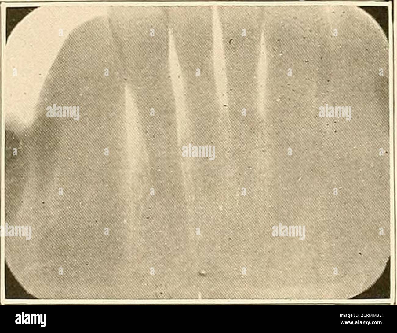 . Oral sepsis in its relationship to systemic disease . Fig. 33. Fig ...