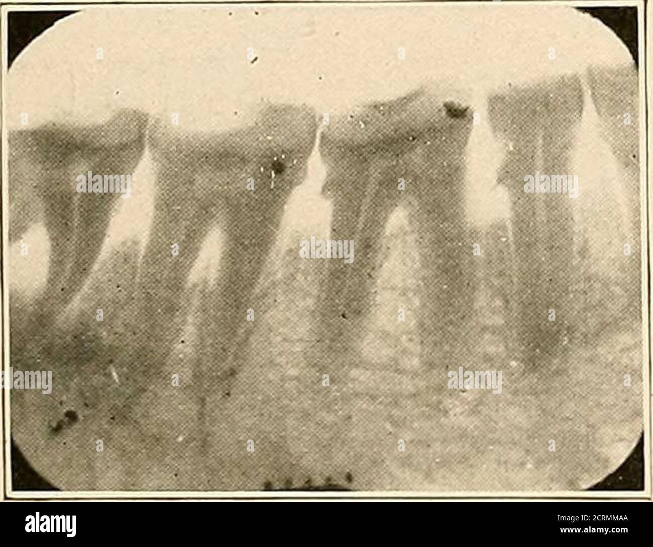 . Oral sepsis in its relationship to systemic disease . Fig. 27. Fig ...