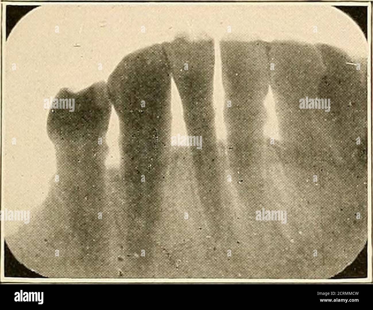 . Oral sepsis in its relationship to systemic disease . Fig. 25. Fig ...