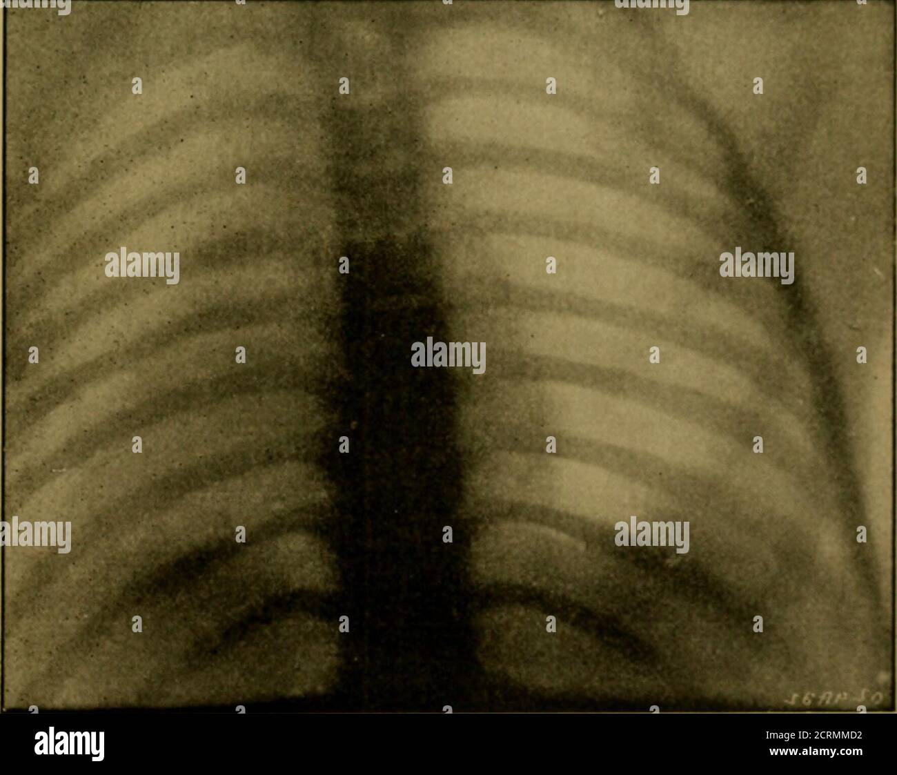 . Radiography and the 'X' rays in practice and theory : with ...