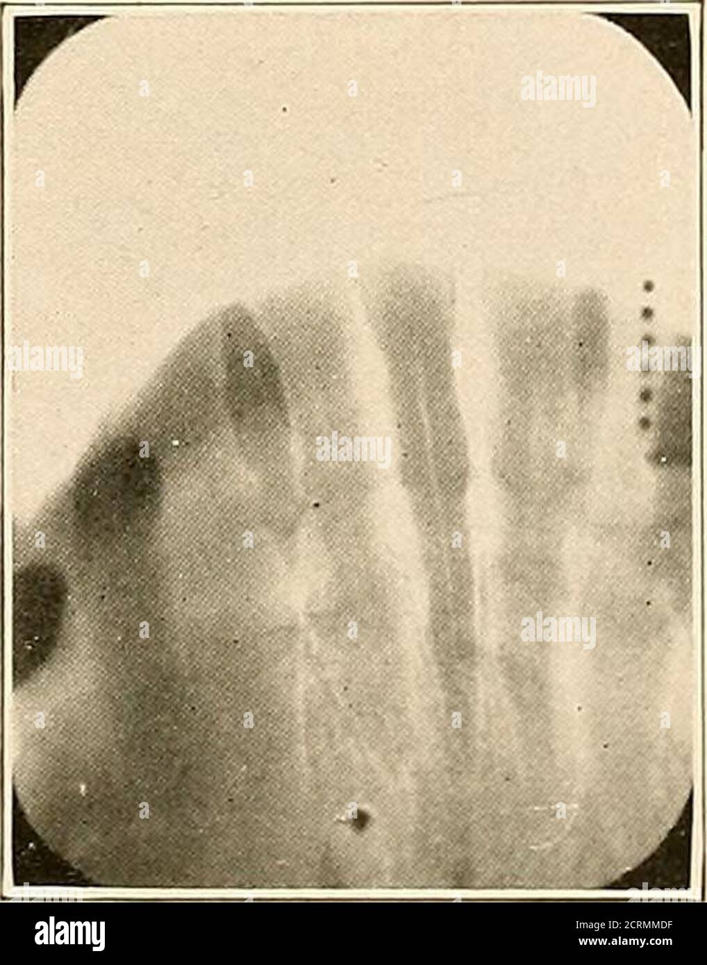 . Oral sepsis in its relationship to systemic disease . Fig. 29. Fig ...