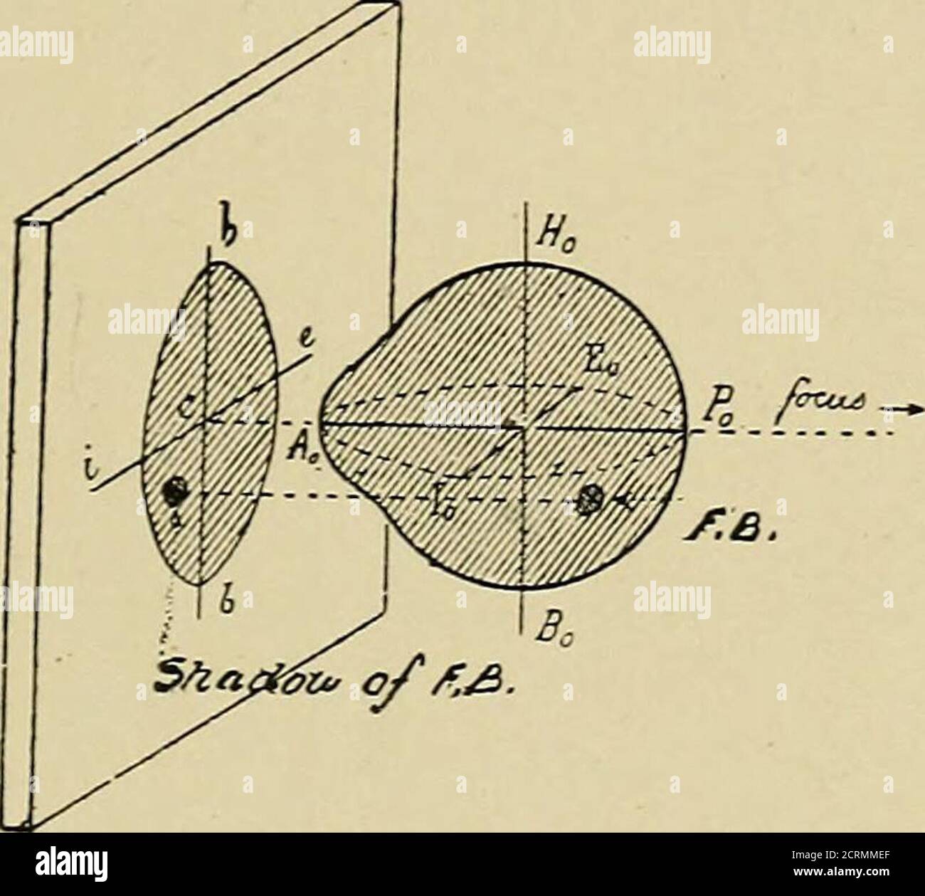 . X-ray observations for foreign bodies and their localisation ...
