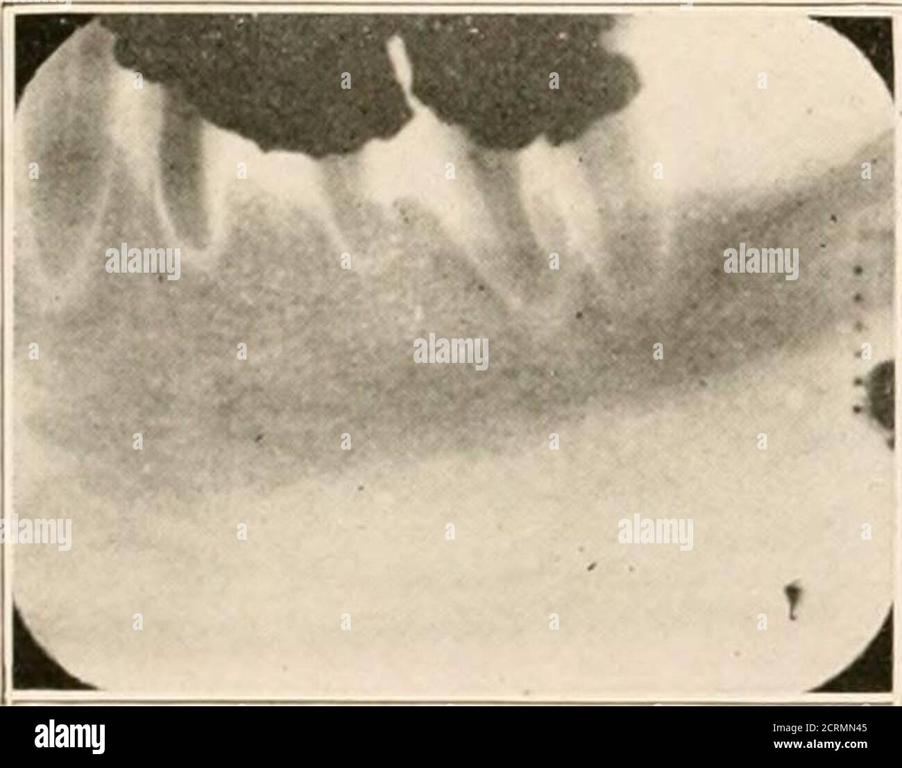 . Oral sepsis in its relationship to systemic disease . Fig. 18. Fig ...