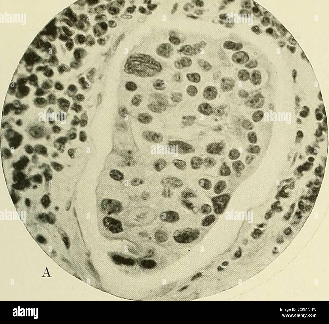 Alveoli and blood vessels hi-res stock photography and images - Alamy