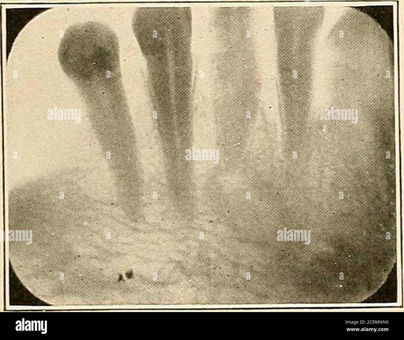 . Oral sepsis in its relationship to systemic disease . Fig. 7. Fig. 8 ...