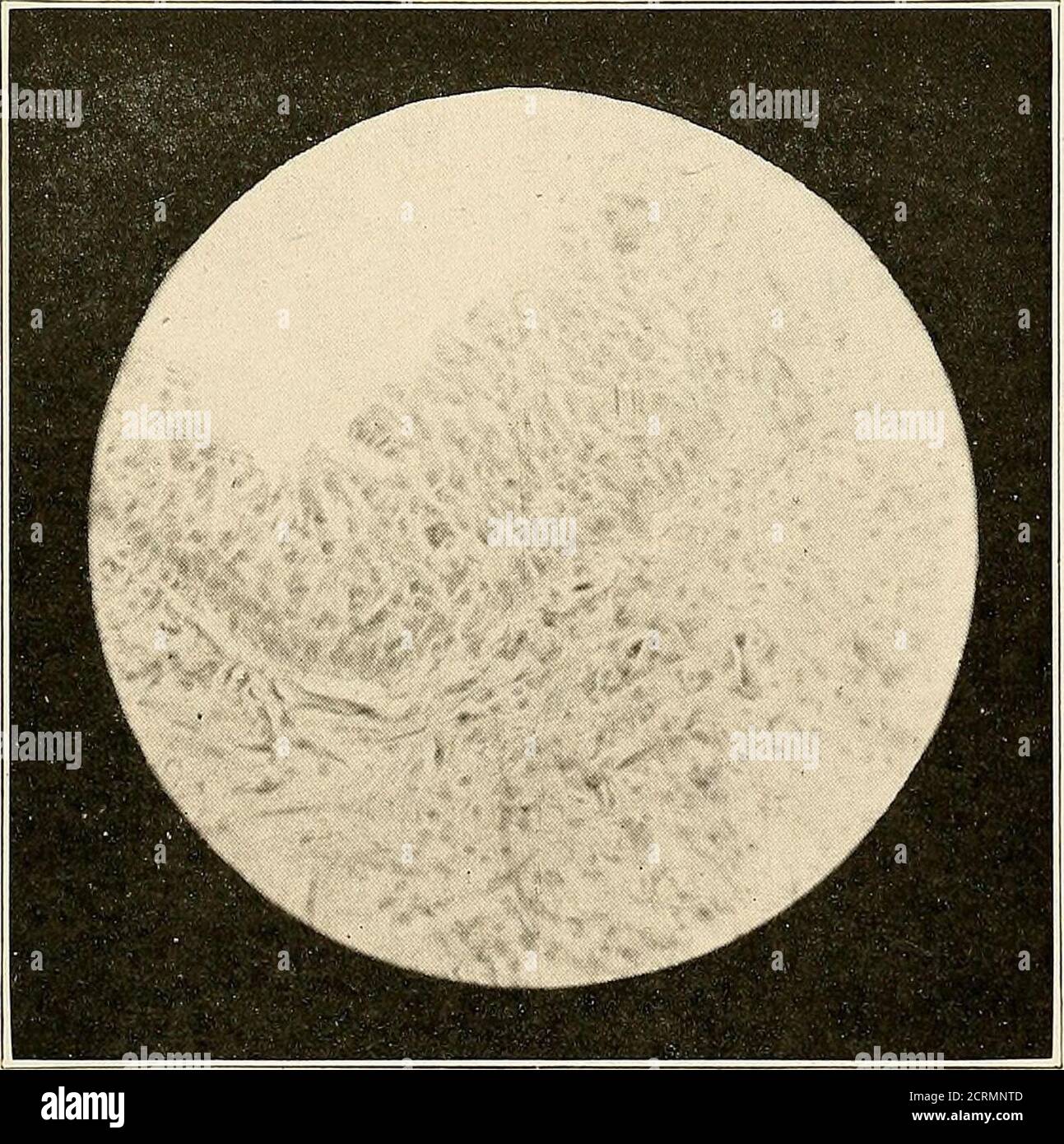 . Interpretation of dental & maxillary roentgenograms . Fig. 18.—Early ...