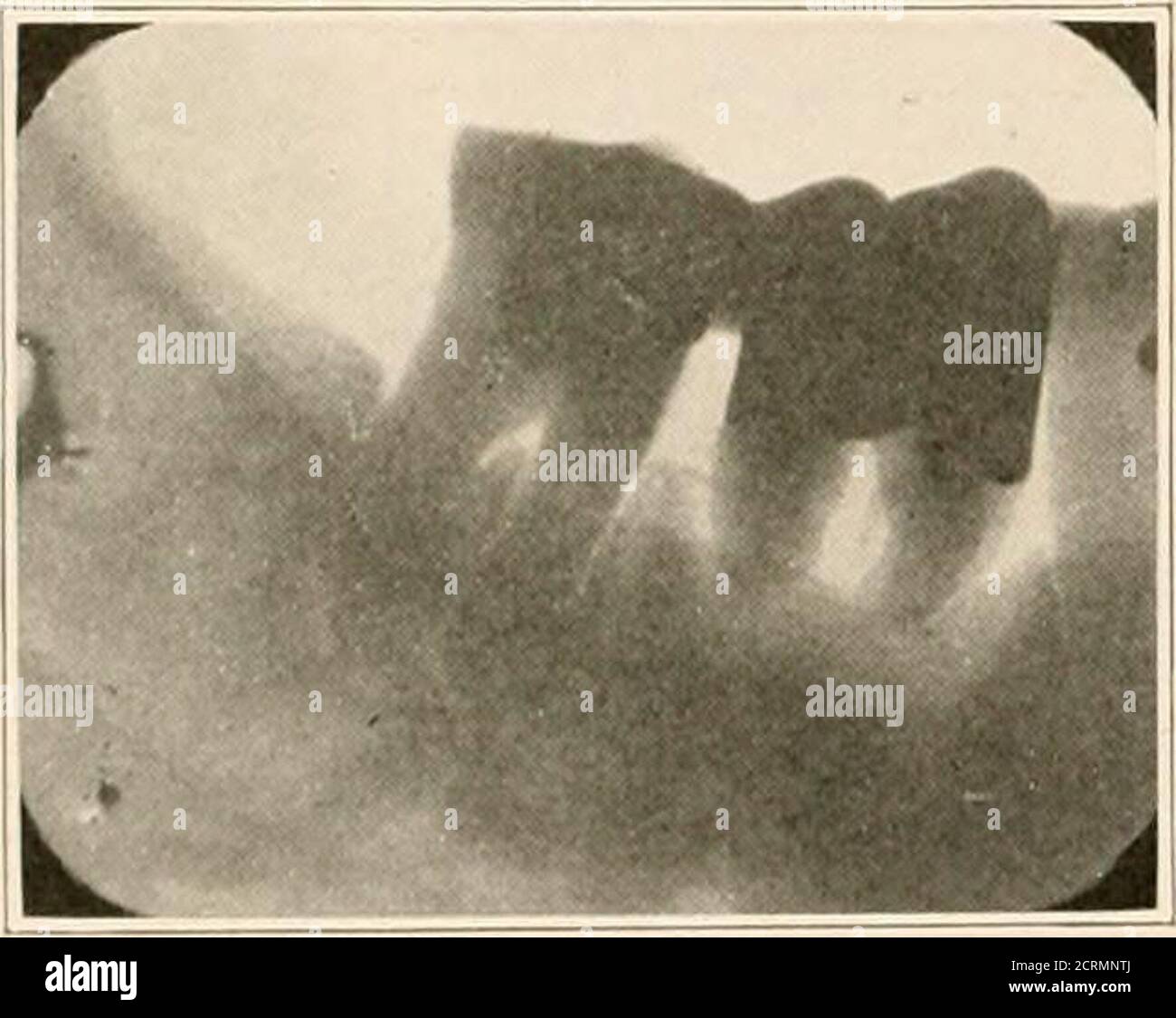 . Oral sepsis in its relationship to systemic disease . Fig. 11. Fig ...