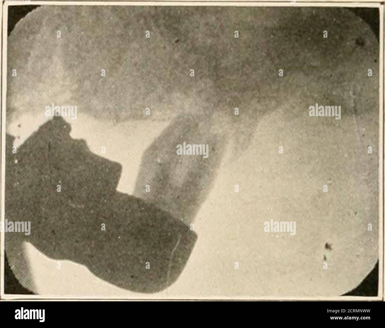 . Oral sepsis in its relationship to systemic disease . Fig. 11. Fig ...