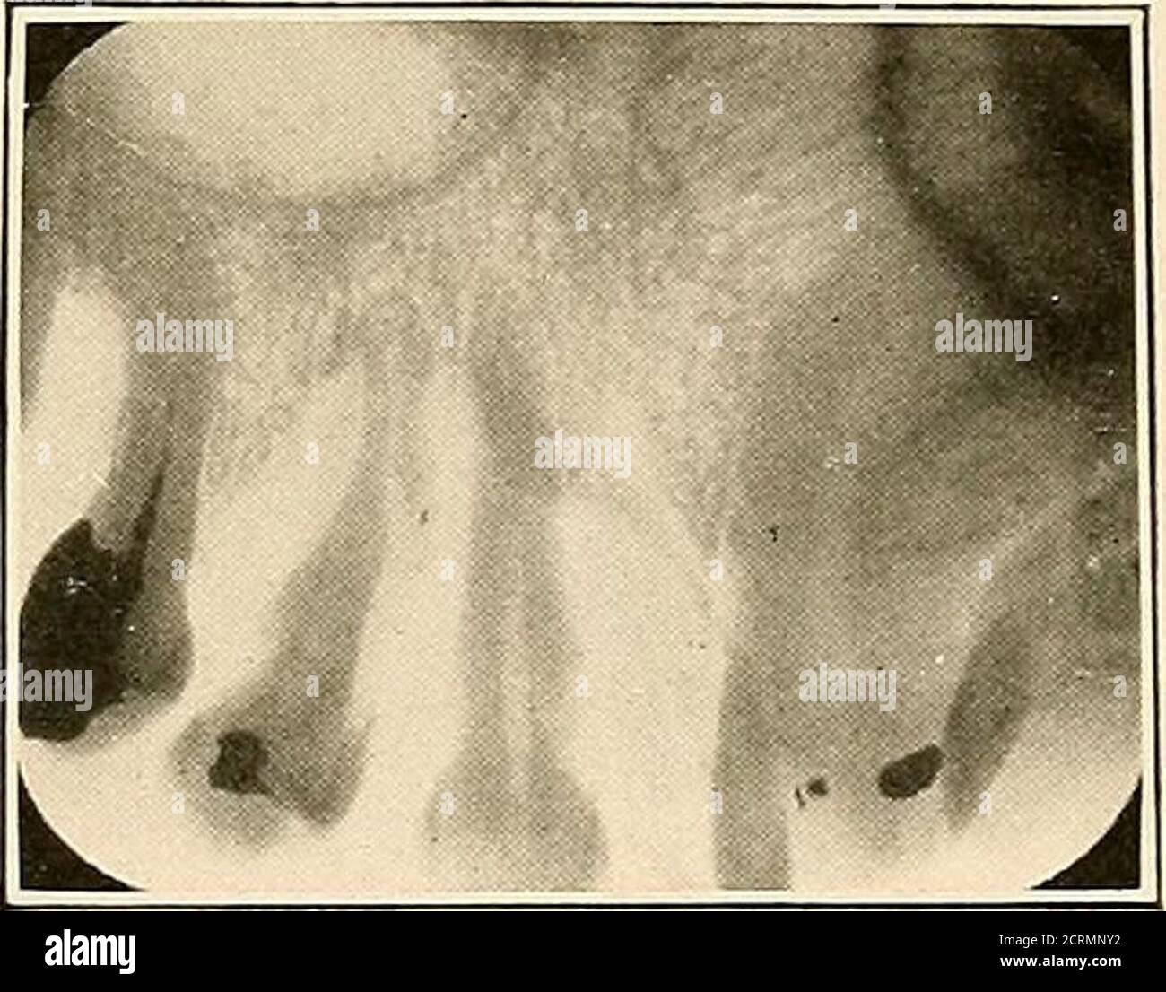 . Oral sepsis in its relationship to systemic disease . Fig. 7. Fig. 8 ...