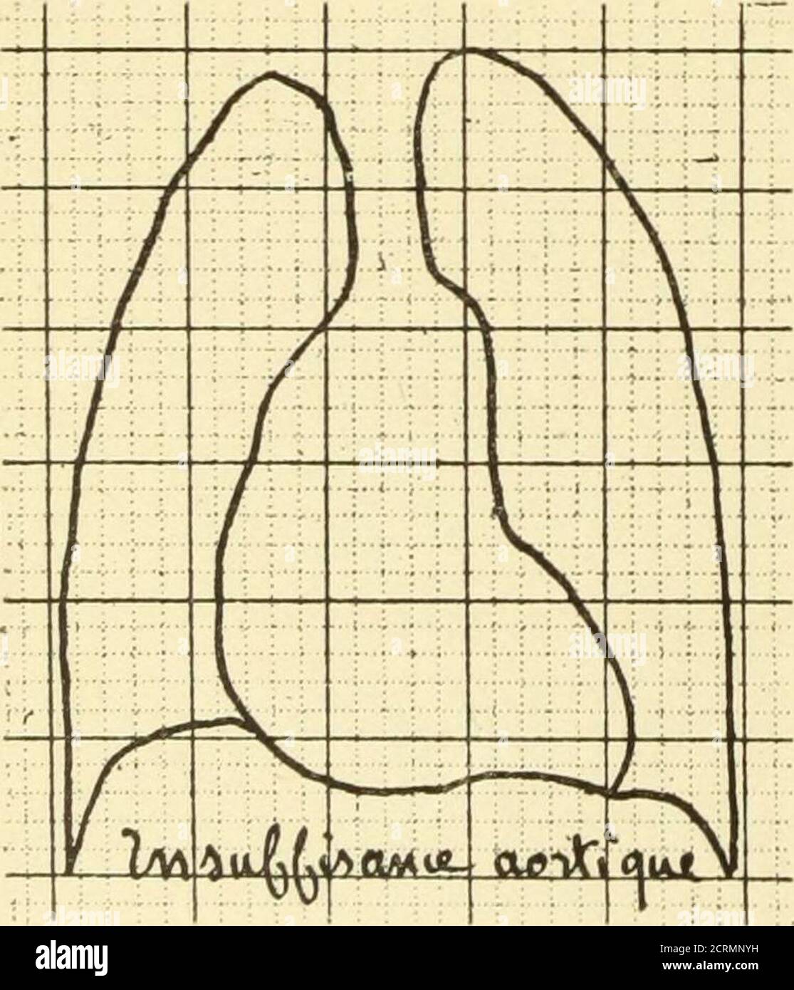 Medecine etude dessin hi-res stock photography and images - Alamy
