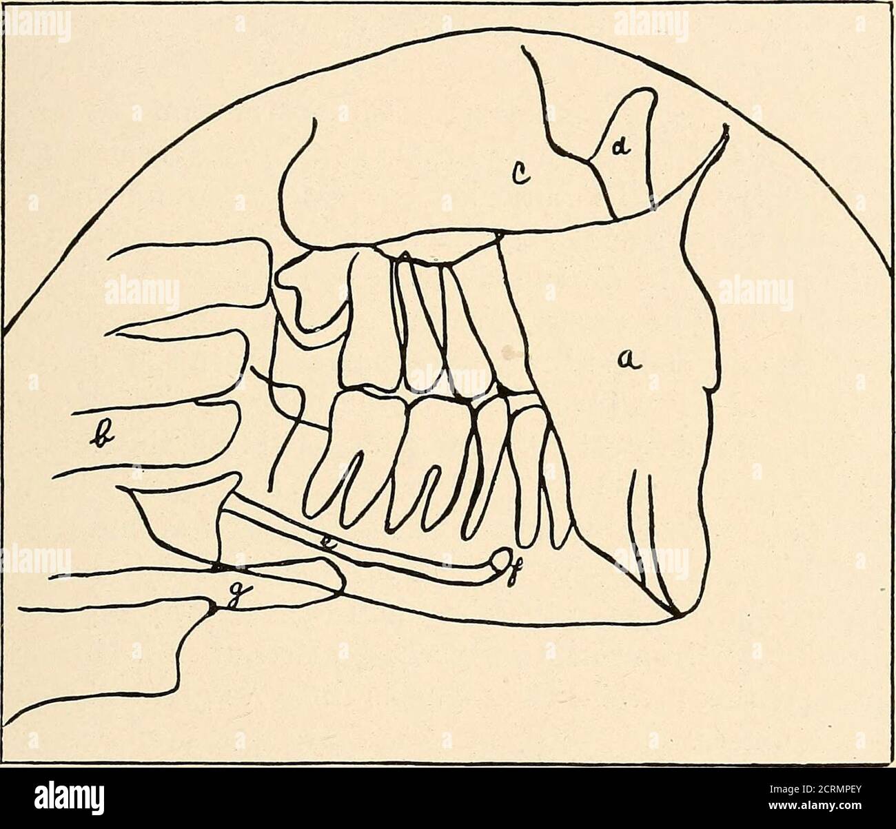. Interpretation of dental & maxillary roentgenograms . Fig. 12.—Plate ...