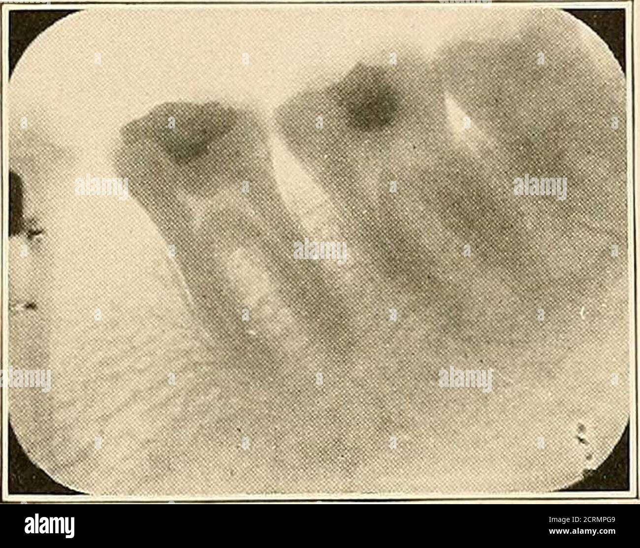 . Oral sepsis in its relationship to systemic disease . Fig. 1. Fig. 2 ...